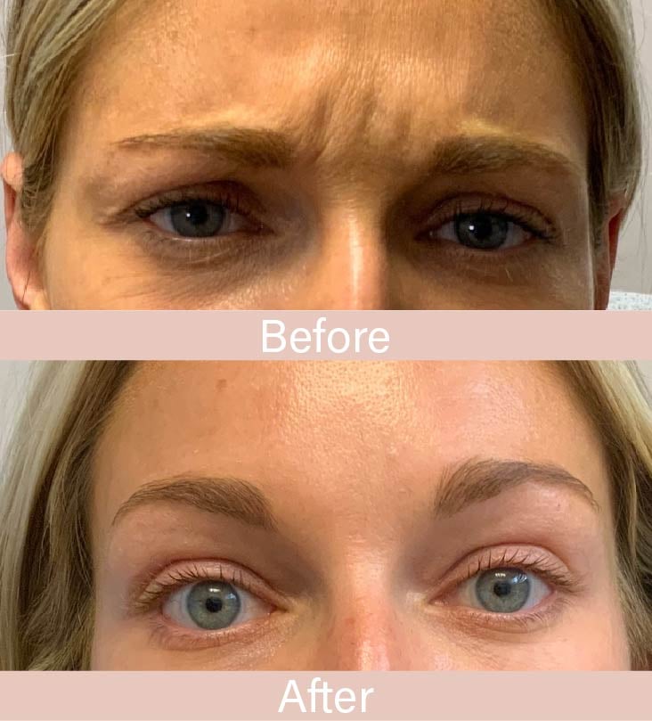 How to Get Your Skin Holiday Ready - Charlotte Magazine