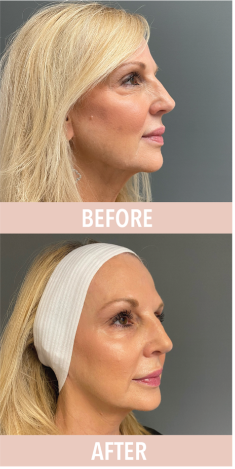 How to Get Your Skin Holiday Ready - Charlotte Magazine