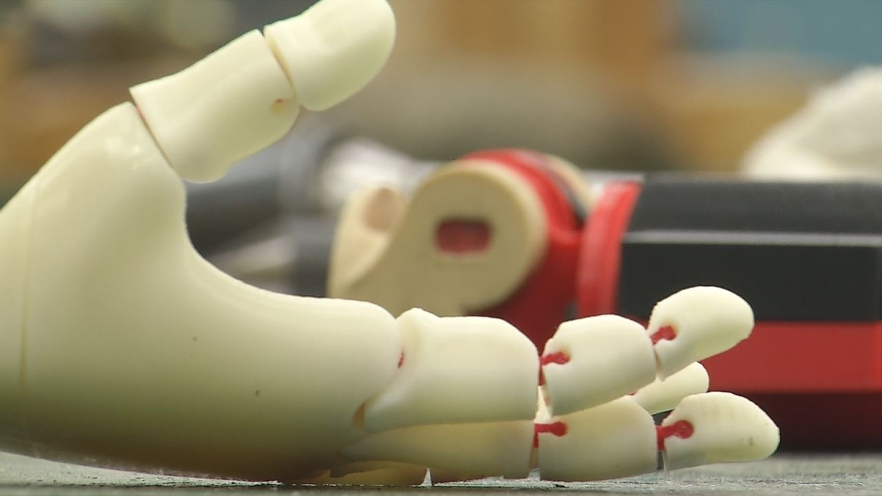 NDSU Award Winning Team Builds Affordable Prosthetics - KVRR Local News