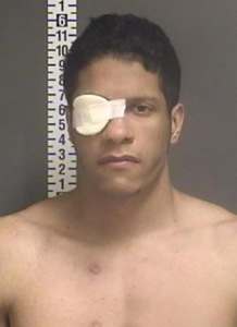 Mother Says Son's Eye Damaged During Arrest By Fargo Police - KVRR ...