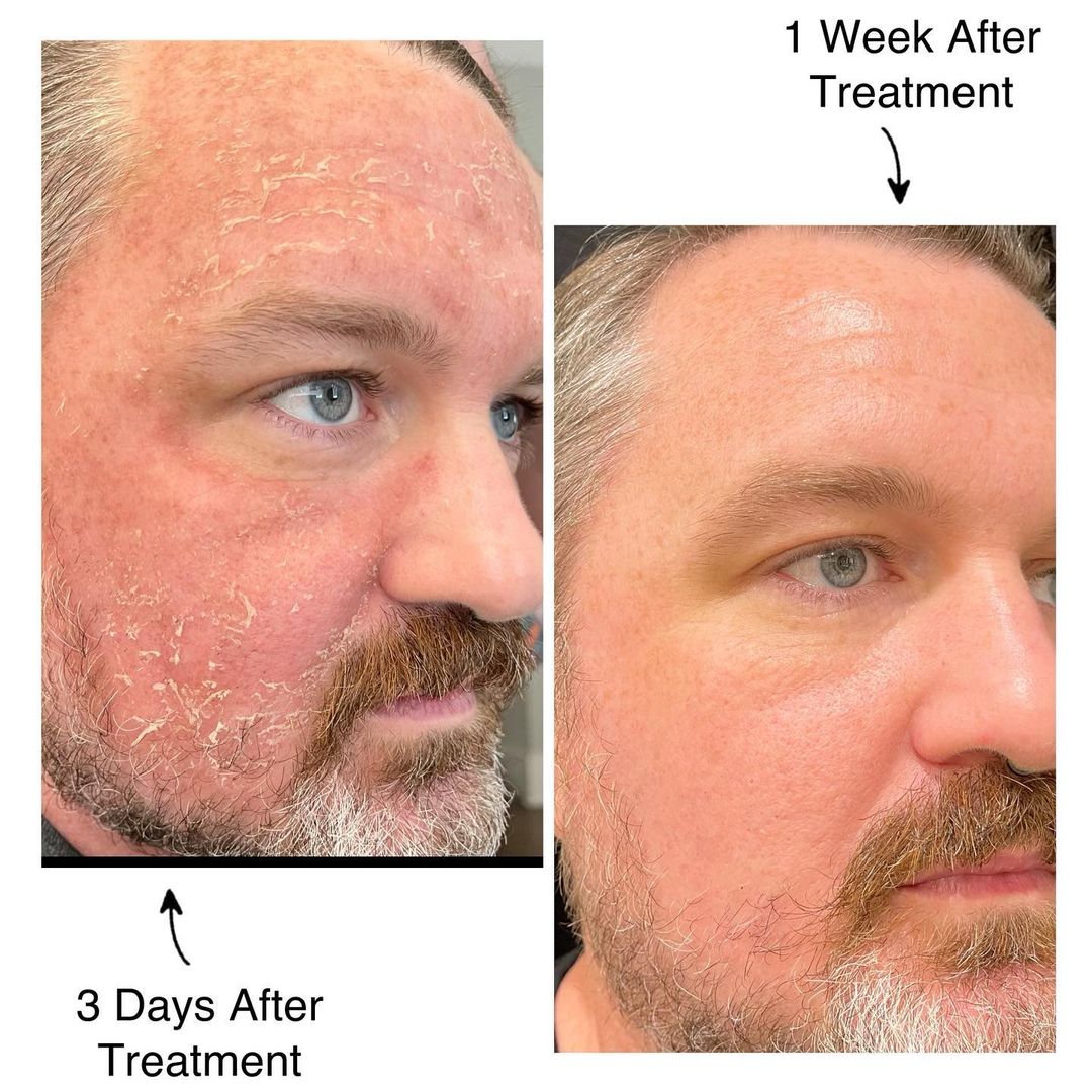 Enhance Your Natural Beauty with Vitali Medspa's Platelet Rich Plasma ...